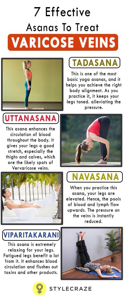 7 Effective Asanas To Treat Varicose Veins