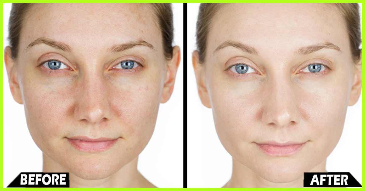 38 Home Remedies To Get Rid Of Dry Skin On The Face 38 Home Remedies To Get Rid Of Dry Skin On The Face