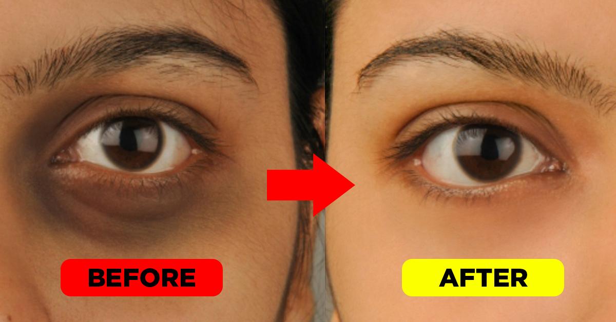 11 Ways To Look Like You Got A Great Night's Sleep (When You Haven't)!