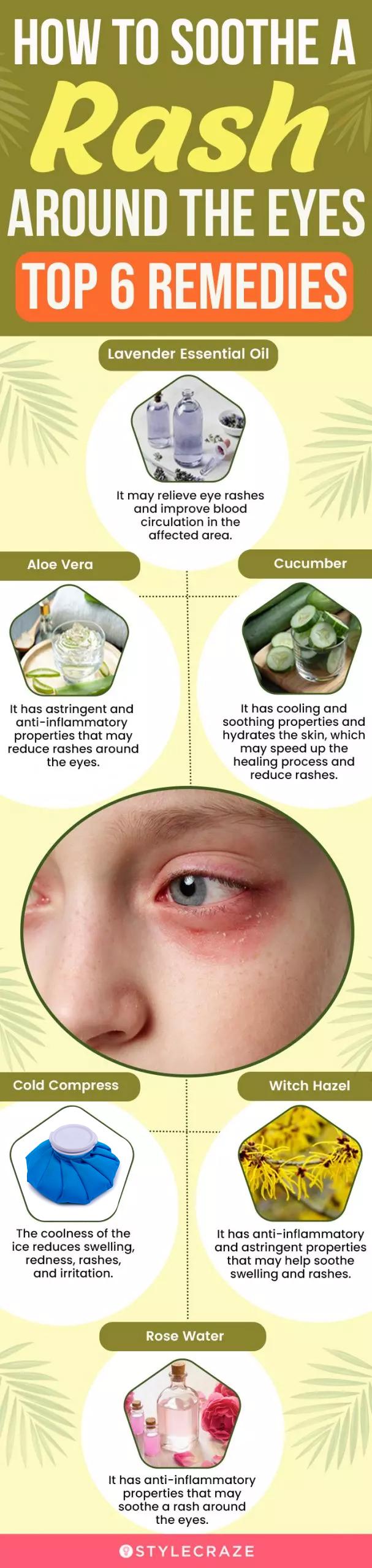 Red Itchy Rash Around Eyes Infoupdate