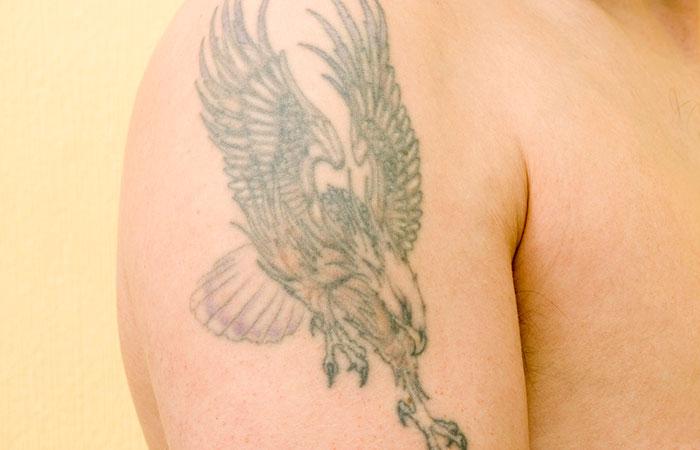 Why Do Tattoos Turn Green? A Closer Look