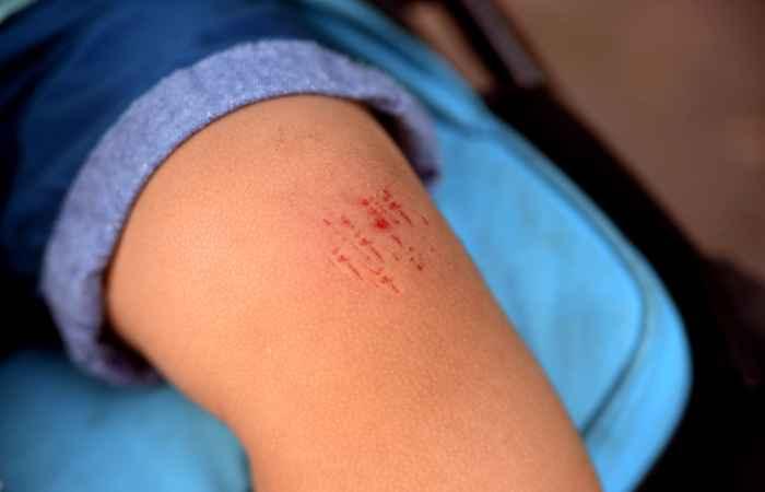 Can You Apply Neosporin On A Tattoo?