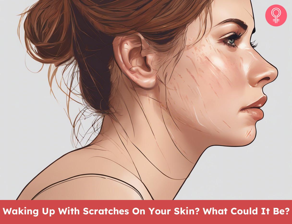 Waking Up With Scratches On Your Skin? What Could It Be?